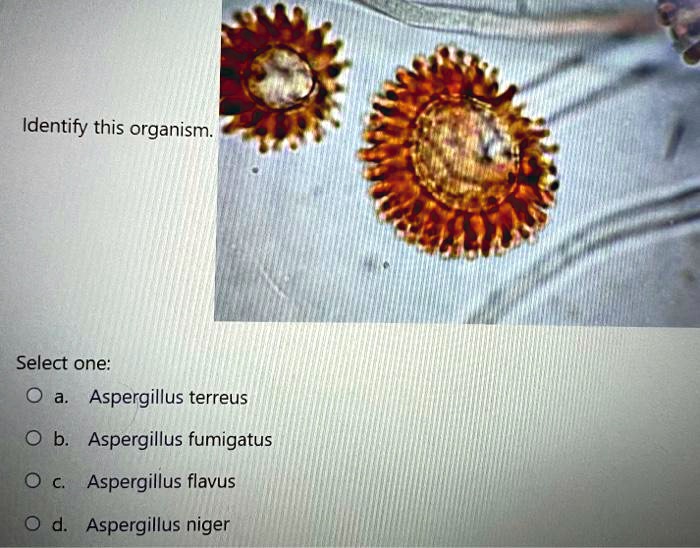 SOLVED: Identify this organism Select one: Aspergillus terreus ...