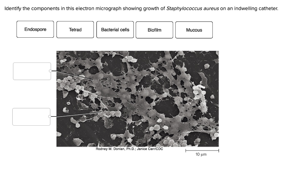 Identify the components in this electron micrograph showing...