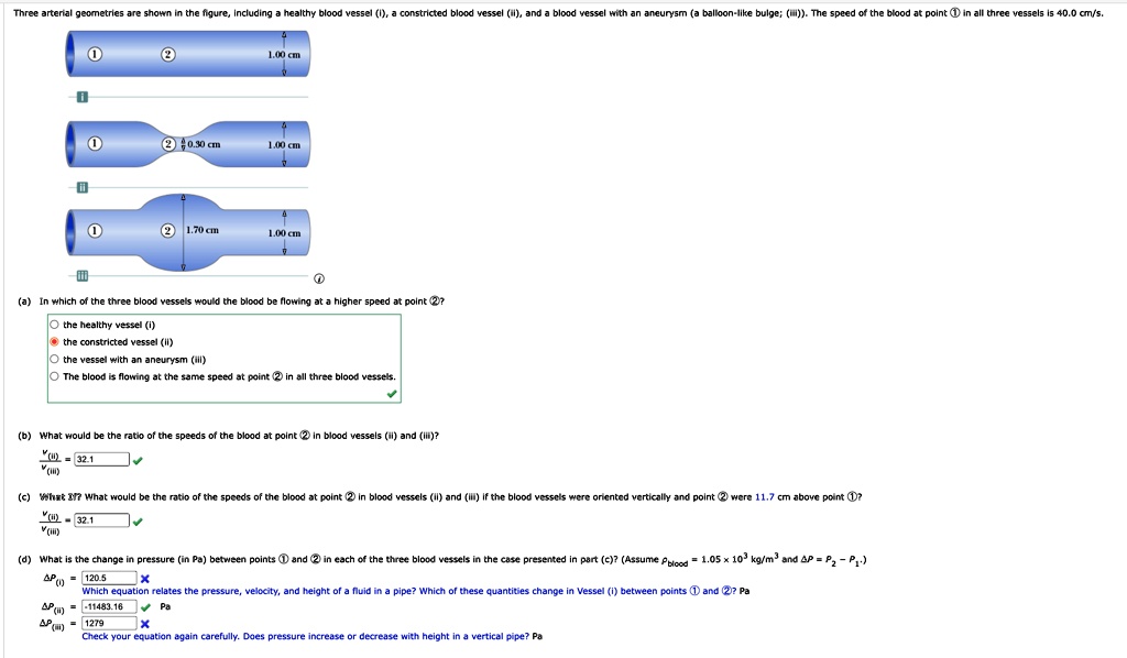 three arterial geometries are shown in the figure including a healthy ...