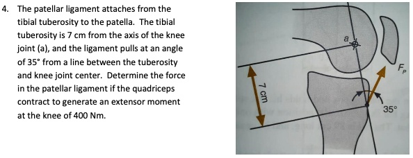 SOLVED: The patellar ligament attaches from the tibial tuberosity to ...