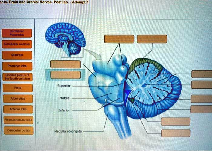 SOLVED: Text: Brain and Cranial Nerves. Post lab. - Attempt 1 ...