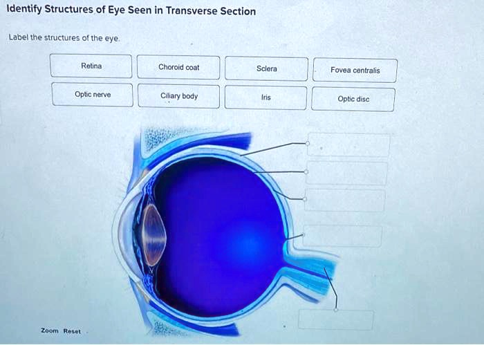 SOLVED: Identify Structures of Eye Seen in Transverse Section Label the ...