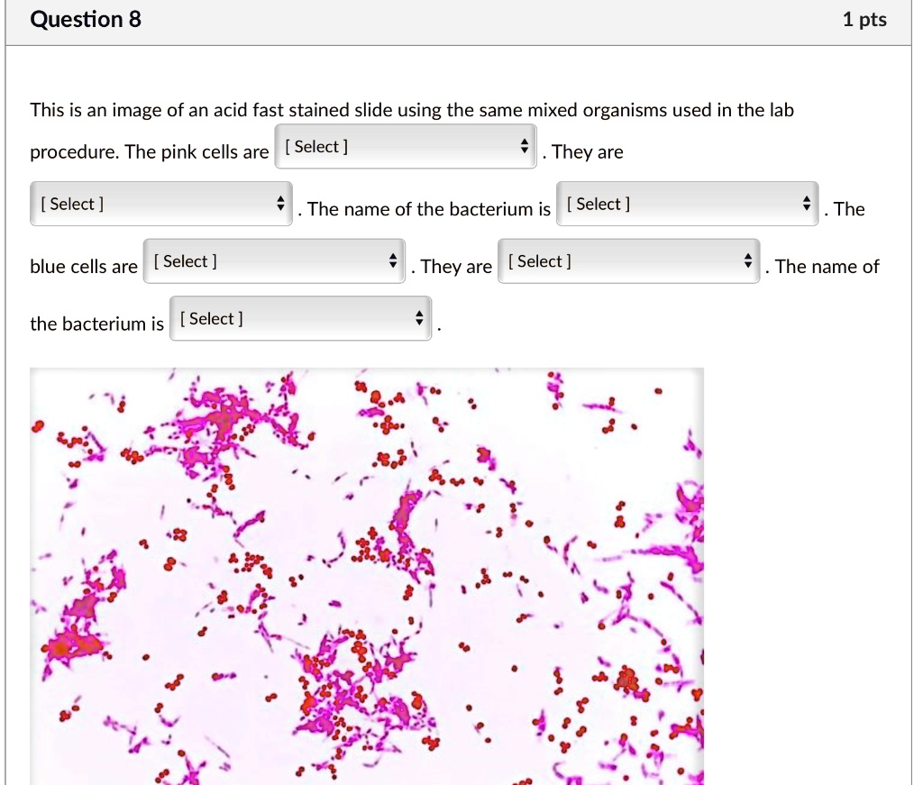 SOLVED: 1. non-acid fast or acid-fast 2. spiral, cocci, bacilli 3. mycobacterium, bacillus ...