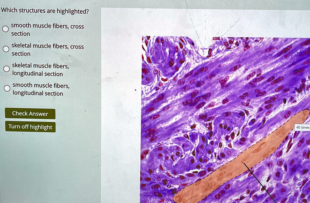 which structures are highlighted smooth muscle fibers cross section ...