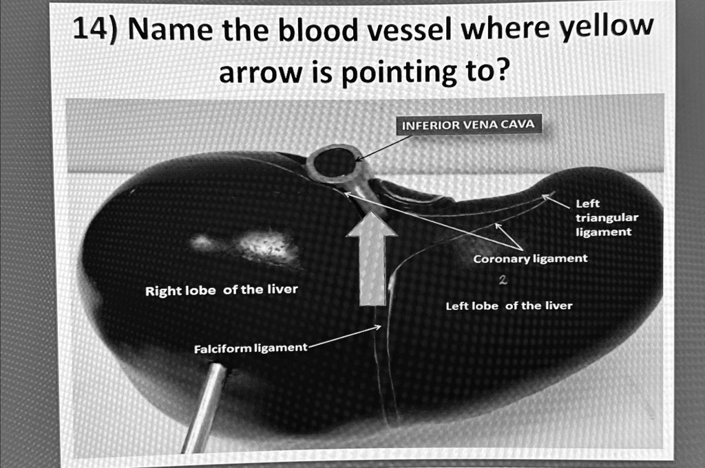 name the blood vessel where the yellow arrow is pointing to 14 name the ...