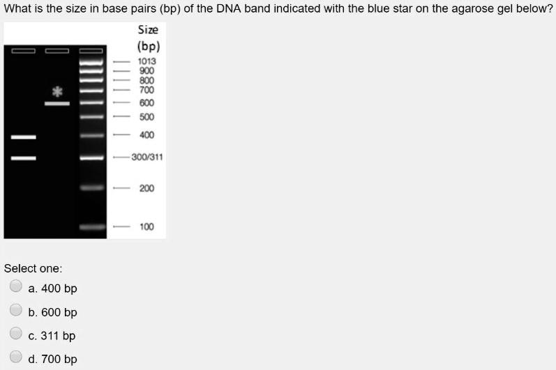 SOLVED: What is the size in base pairs (bp) of the DNA band indicated ...