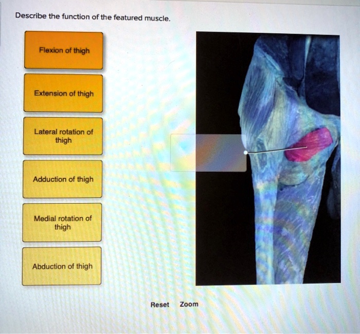 Describe the function of the featured muscle. Flexion of...