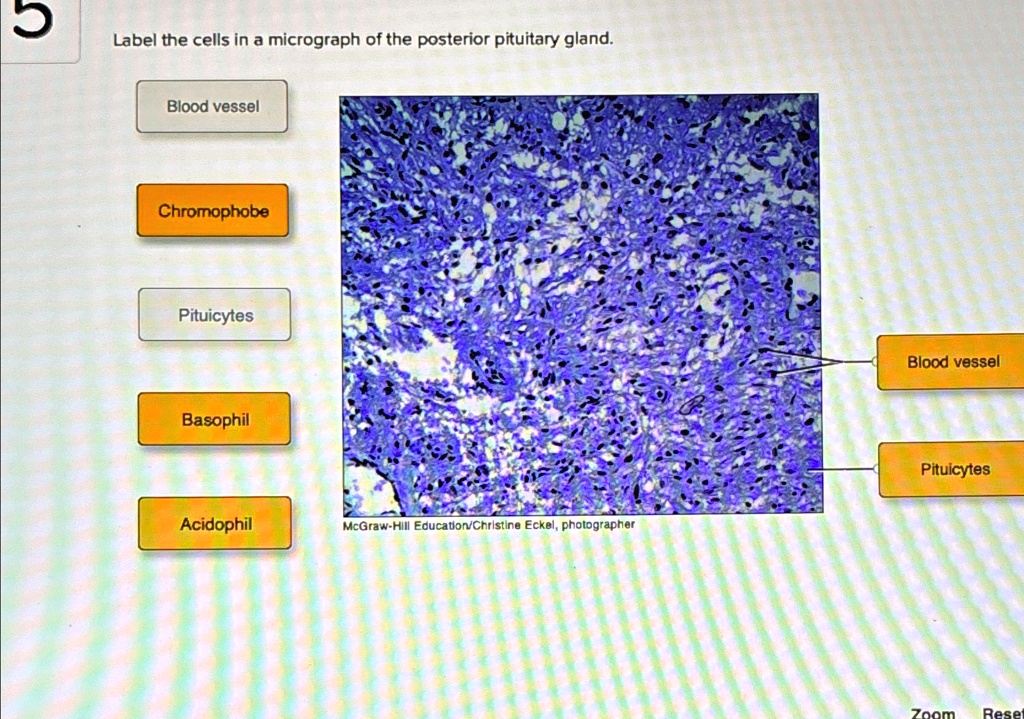 5 Label the cells in a micrograph of the posterior pituitary gland ...