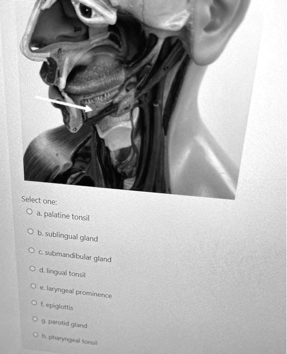 SOLVED:Select one; palatine tonsil sublingual gland submandibular ...