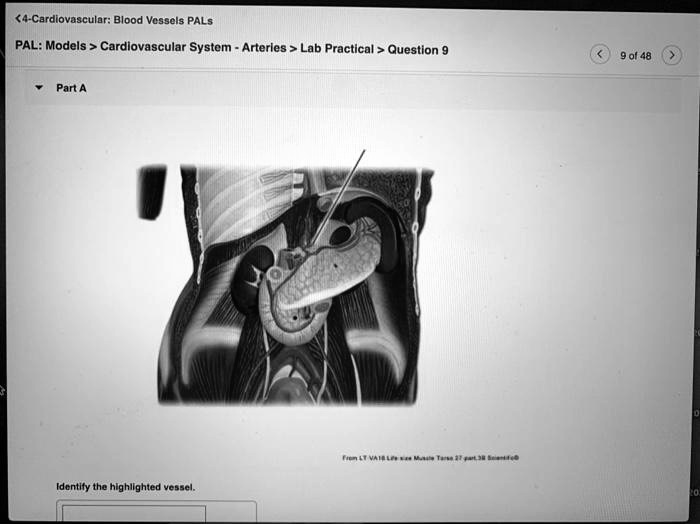 SOLVED: Text: Cardiovascular System - Arteries> Lab Practical> Question ...