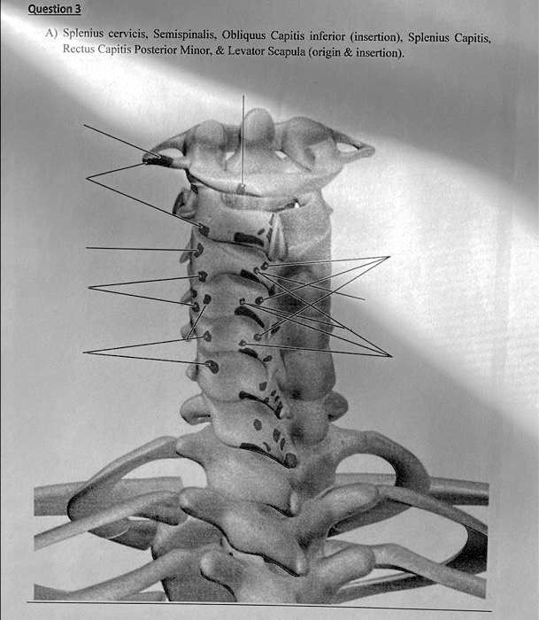[GET ANSWER] Question 3 A) Splenius cervicis, Semispinalis, Obliquus ...