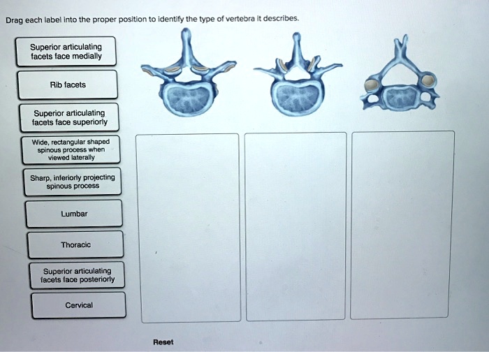 drag each label into the proper position to identify the type of vertebra describes superior ...