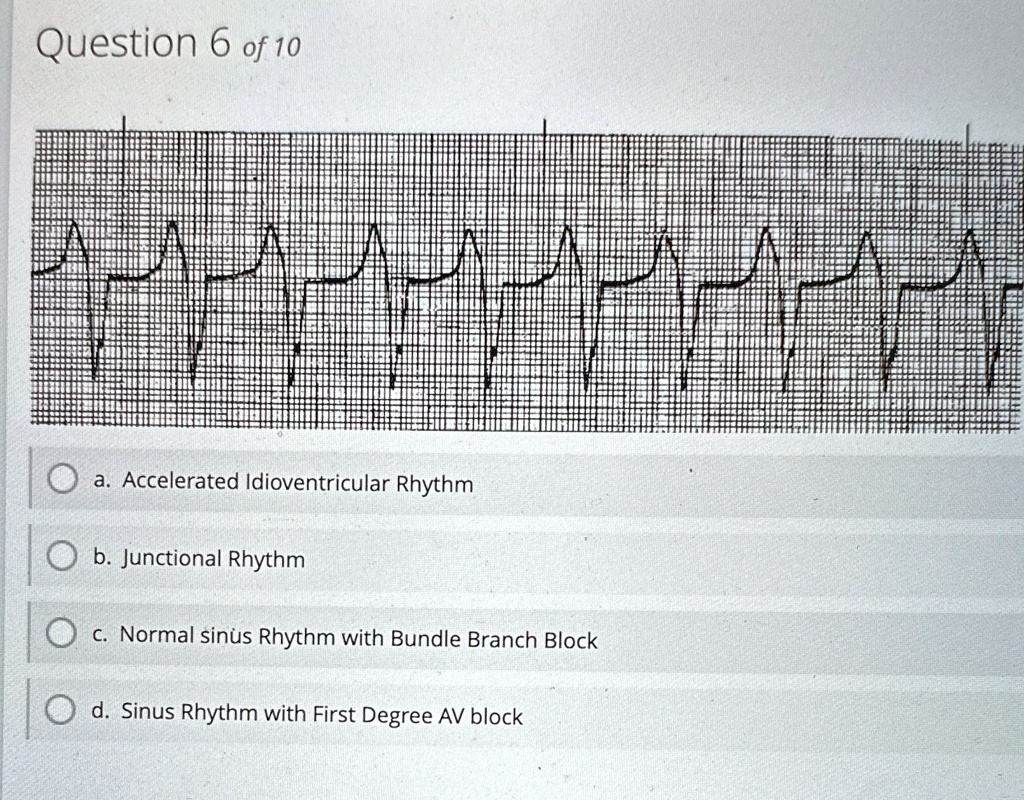 question 6 of 10 a accelerated idioventricular rhythm b junctional ...