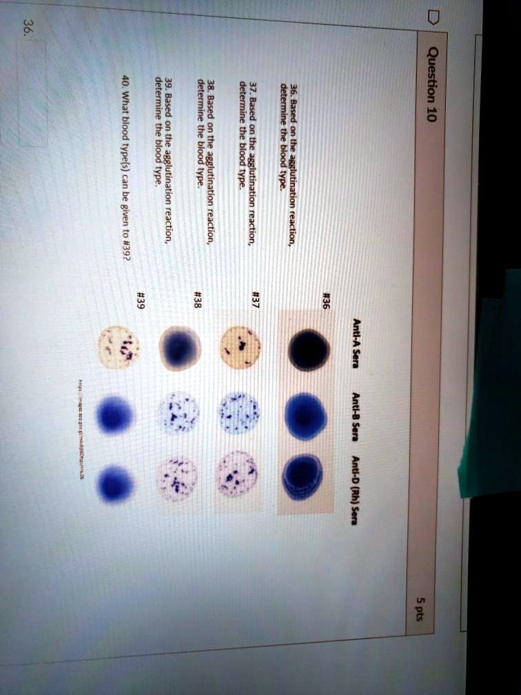 VIDEO solution: What blood type(s) can be given to determine the blood ...