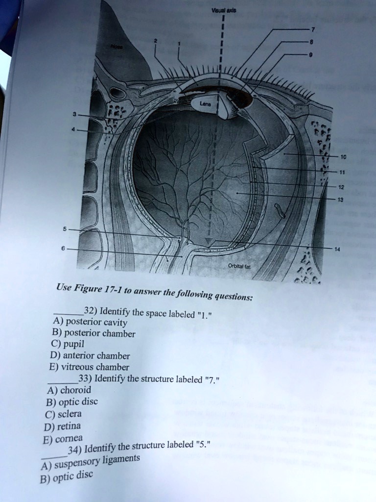 Use Figure 17-1 to answer the following questions: 32) Identify the ...