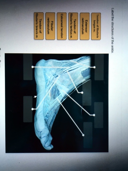 Label the structures of the ankle. Tendon of fibularis longus m ...