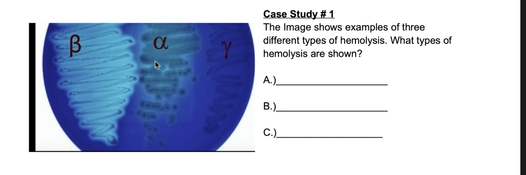 Case Study #1 The Image shows examples of three different types of ...