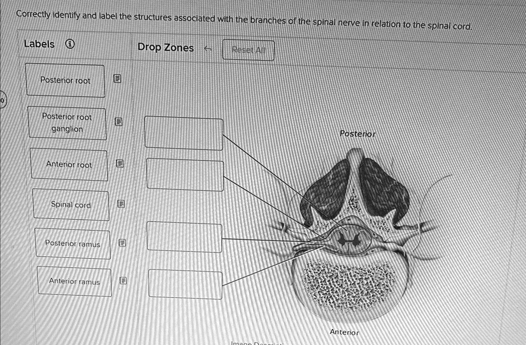 Correctly identify and label the structures associated with the ...