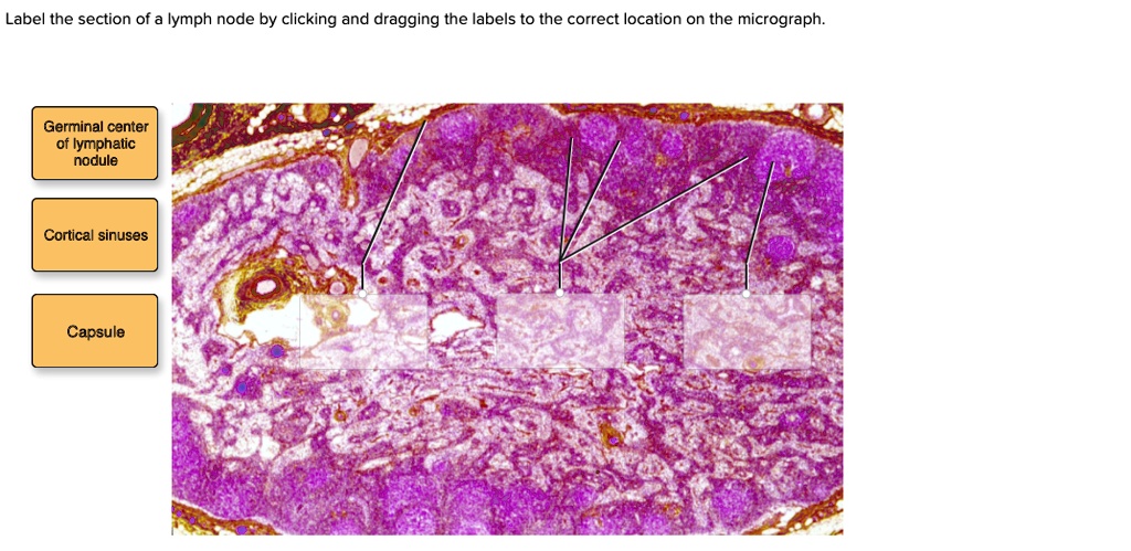 Solved Label The Sections Of A Lymph Node By Clicking And Dragging The Labels To The Correct