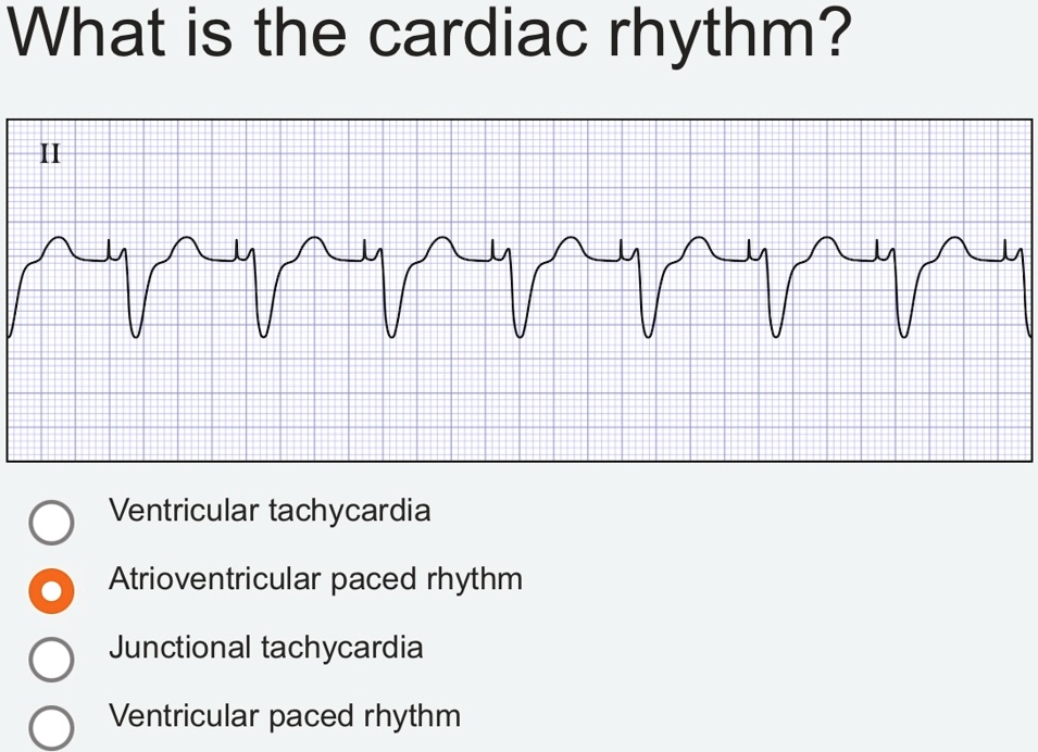what is the cardiac rhythm shown in the ekg strip below choose between ...
