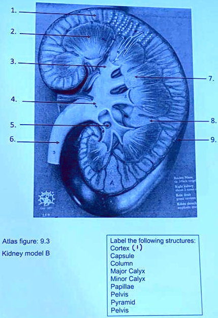 please help label Atlas figure: 9.3 Kidney model B Label the following ...