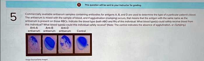 5 Commercially available antiserum samples containing antibodies for ...