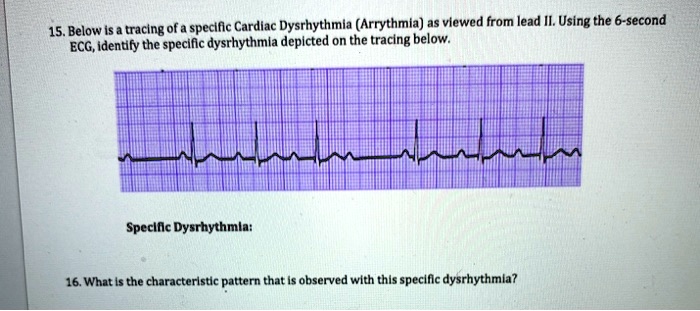 15 below is tracing of a speclflc cardiac dysrhythmia...