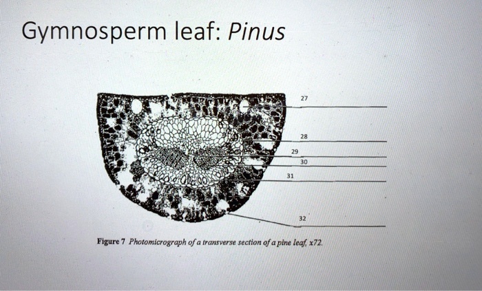 [GET ANSWER] Gymnosperm leaf: Pinus 27 29 28 30 31 32 Figure 7 ...
