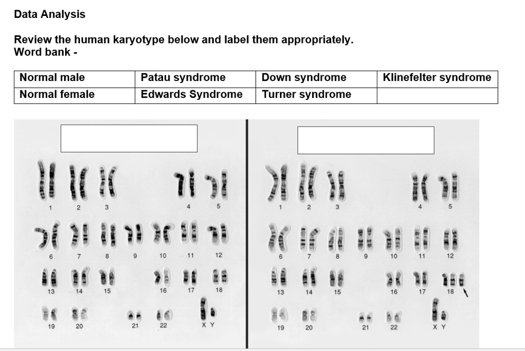 SOLVED: Data Analysis Review the human karyotype below and label them ...
