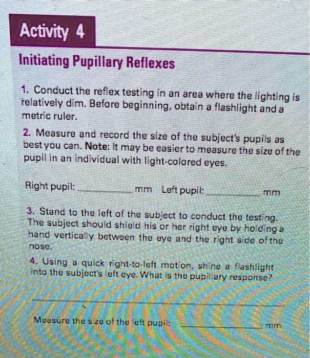 Activity 4 Initiating Pupillary Reflexes 1. Conduct the reflex testing ...