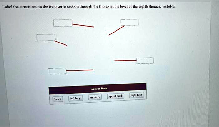 Label the structures on the transverse section through the thorax at ...