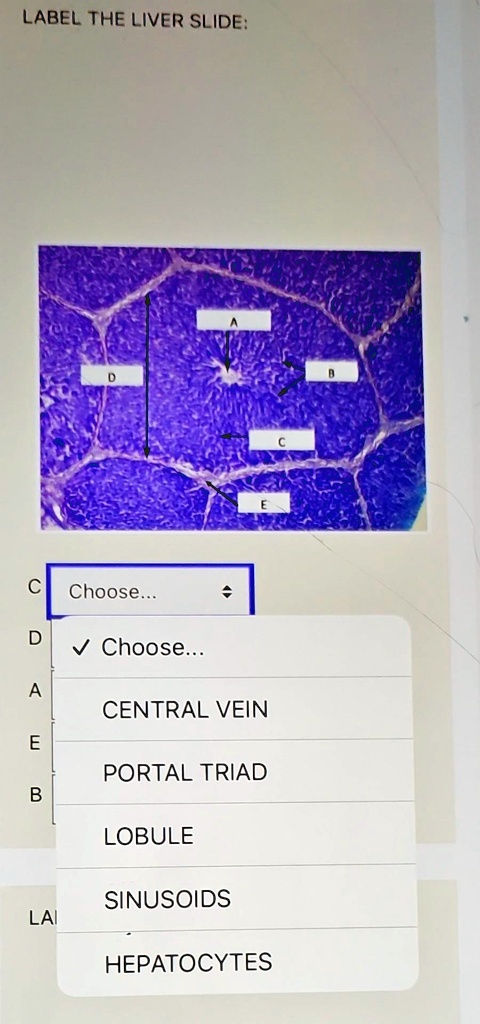 LABEL THE LIVER SLIDE: D A C Choose... D ? Choose... A CENTRAL VEIN E ...