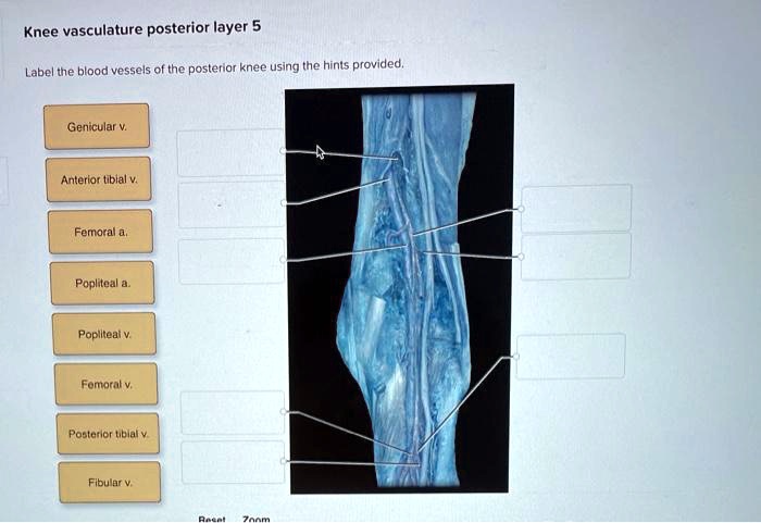 Knee vasculature posterior layer 5 Label the blood vessels of the ...