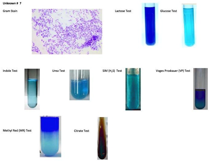 Methyl Red Voges Proskauer Test