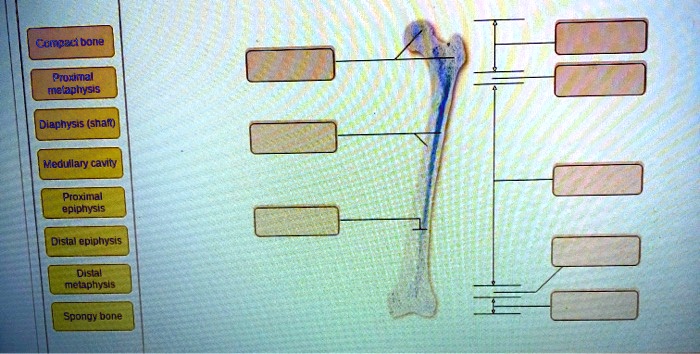 [GET ANSWER] Compact bone Proximal metaphysis Diaphysis (shaft ...