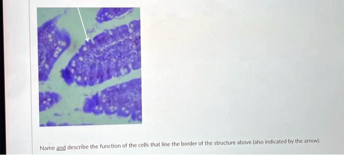 name and describe the function of the cells that line the border of the ...