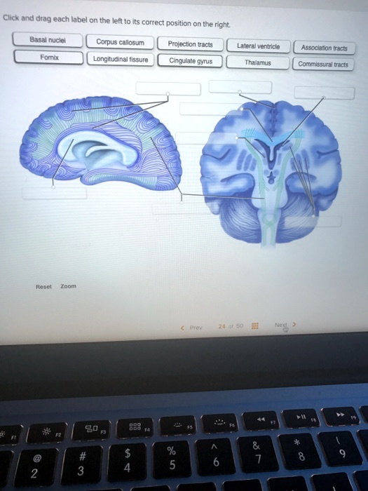 Click and drag each label on the left to its correct position on the right. Basal nuclei Formix ...