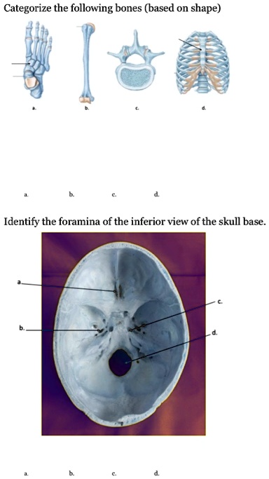 SOLVED: Categorize the following bones (based on shape Identify the foramina of the inferior ...
