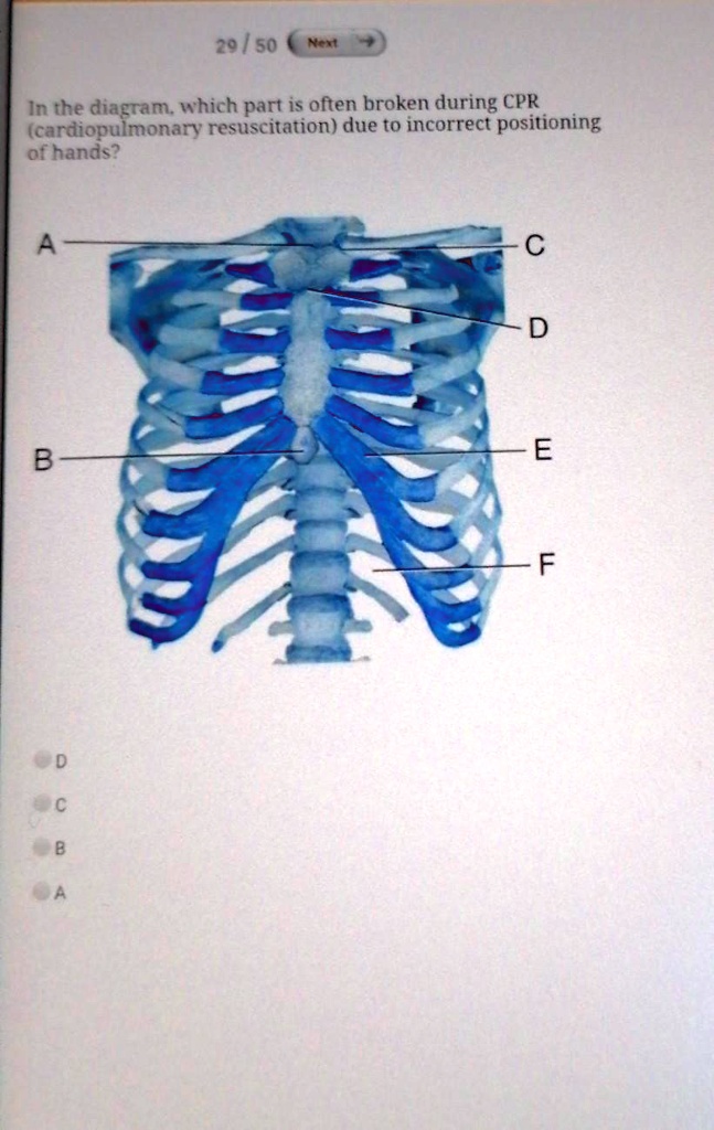 29/50 Next In the diagram, which part is often broken during CPR ...