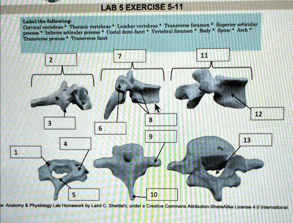 LAB 5 EXERCISE 5-11 Label the following: Cervical vertebrae * Thoracic ...
