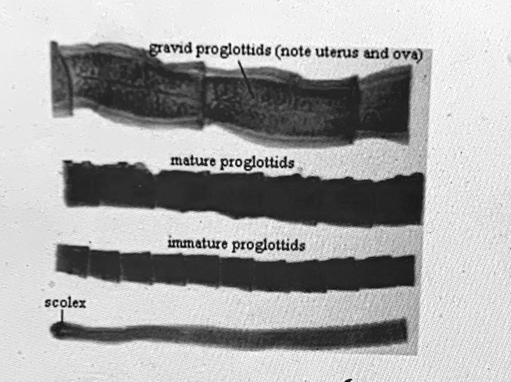 draw the scolex and the cross section of a proglottid and label ...