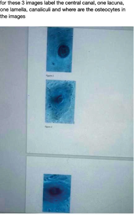 for these 3 images label the central canal, one lacuna, one lamella ...