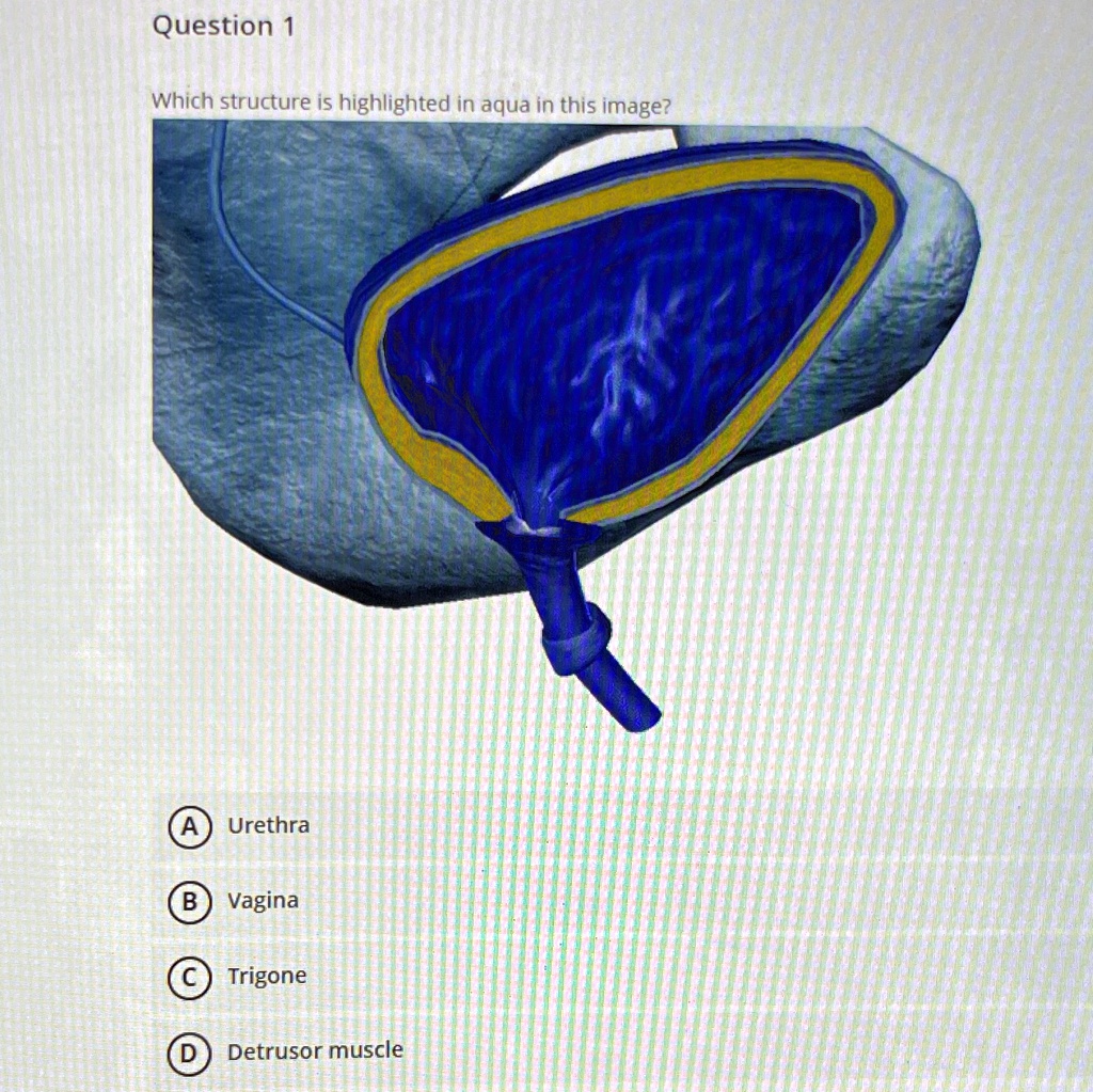 question 1 which structure is highlighted in aqua in this image urethra ...