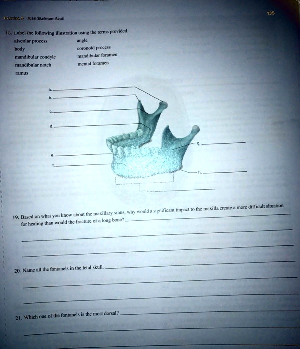Exeraino Ardal Skeleton: Skull 18. Label the following illustration ...