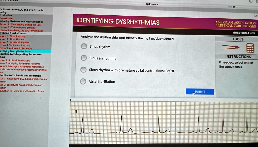 is essentials of ecg and dysrhythmia monitoring introduction monitoring ...