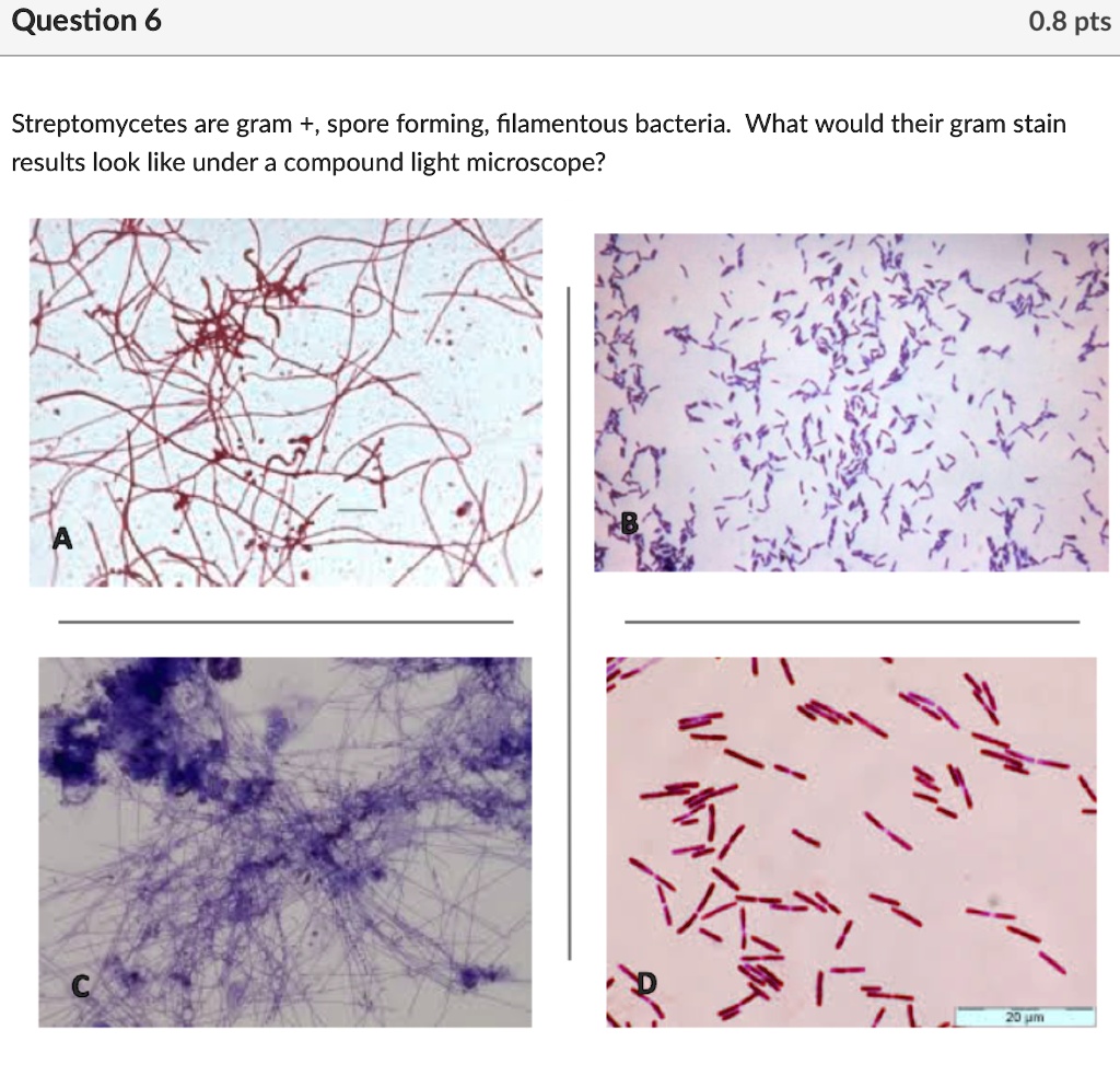 SOLVED:Question 6 0.8 pts Streptomycetes are gram +, spore forming ...