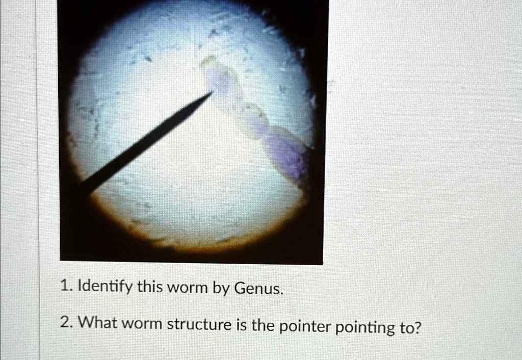 SOLVED: Identify this worm by Genus. What worm structure is the pointer pointing to? 1.ldentify ...