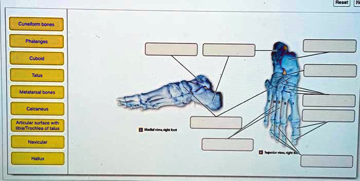 SOLVED: Cuneiform bones Phalanges Cuboid Talus Metatarsal bones ...