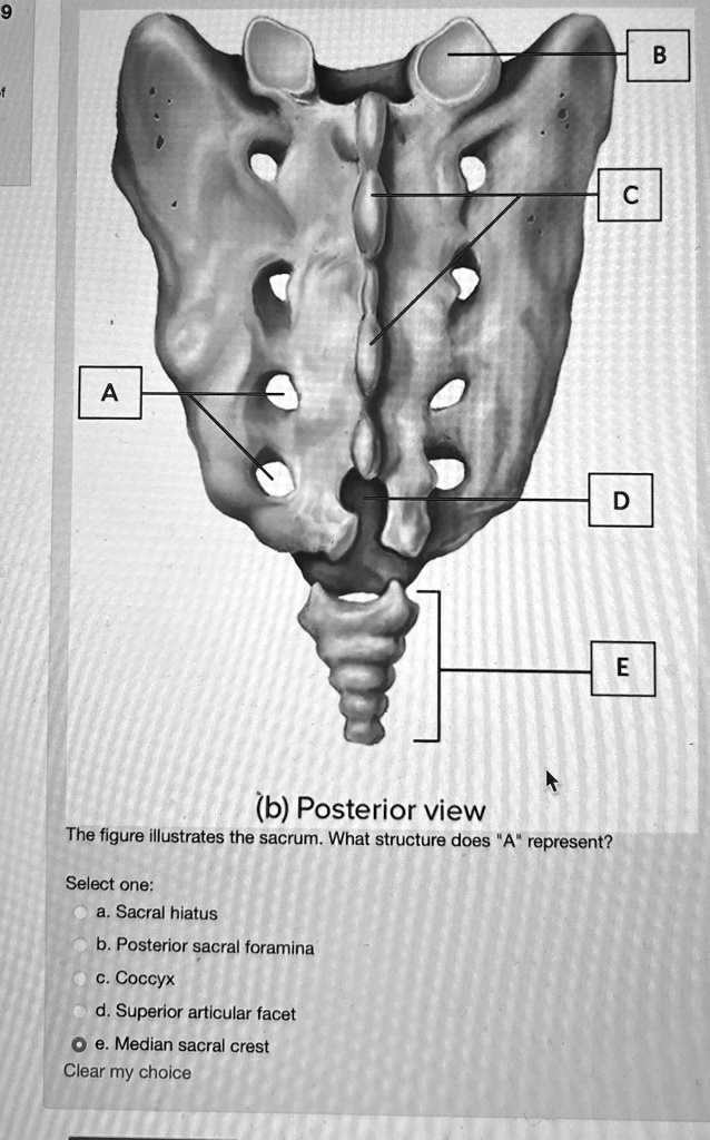 9 (b) Posterior view The figure illustrates the sacrum. What structure ...