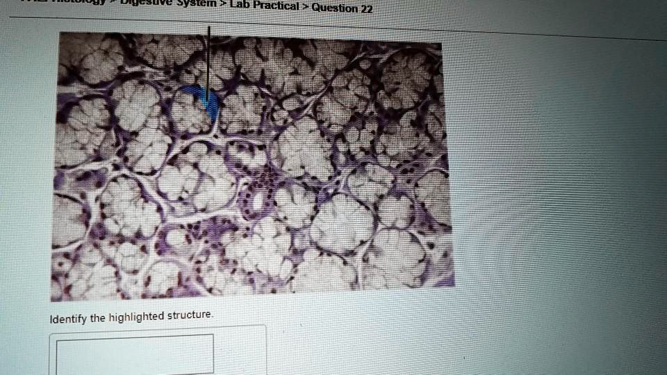 SOLVED: Identify the highlighted structure.